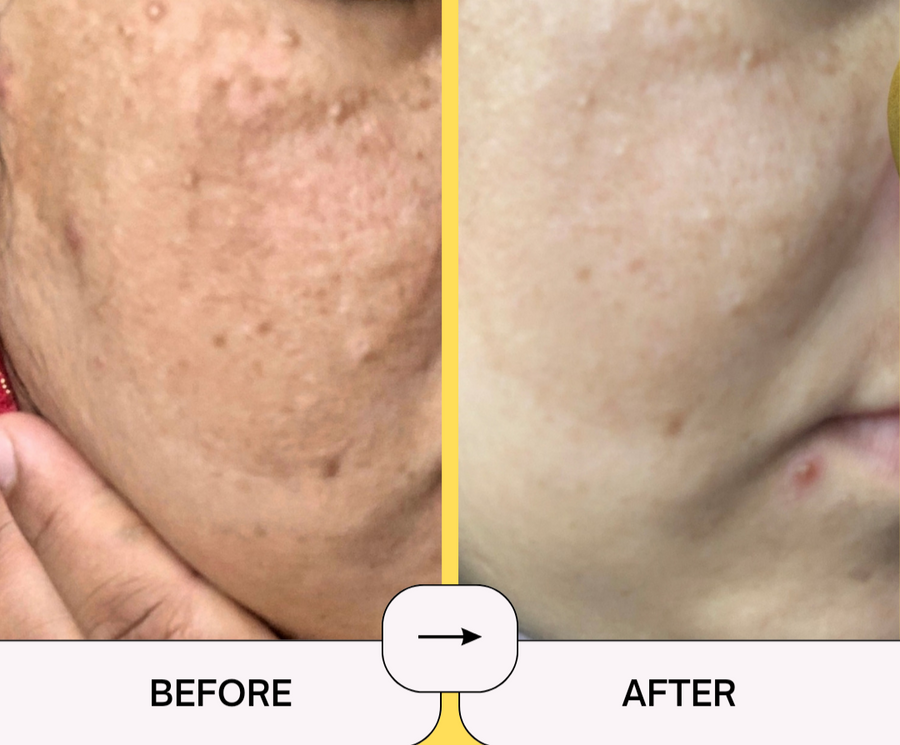 Next Level Skin – Next Level Skin Pty Ltd