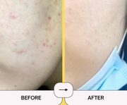 Next Level Skin – Next Level Skin Pty Ltd