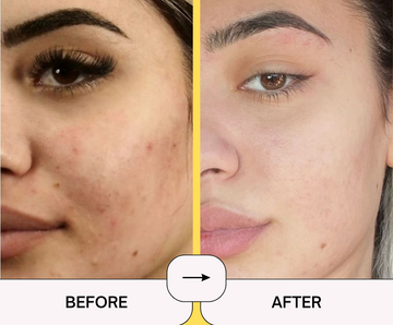 Next Level Skin – Next Level Skin Pty Ltd