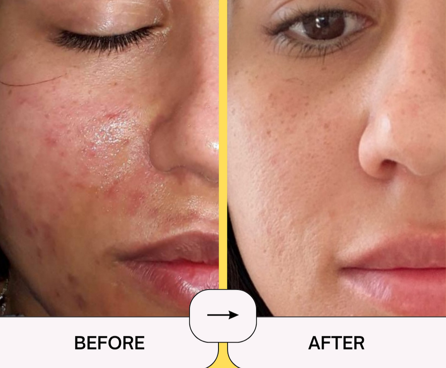 Next Level Skin – Next Level Skin Pty Ltd