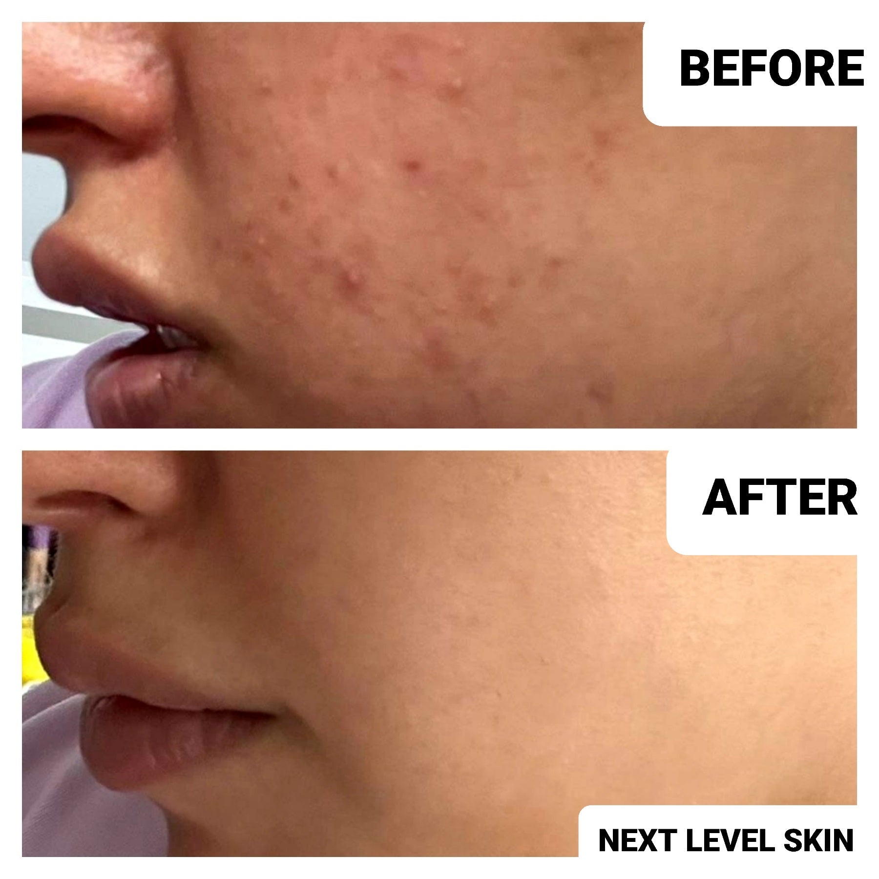 Next Level Skin – Next Level Skin Pty Ltd