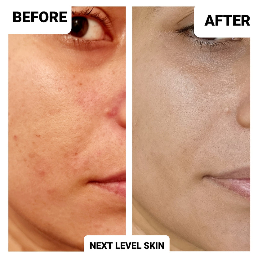 Next Level Skin – Next Level Skin Pty Ltd
