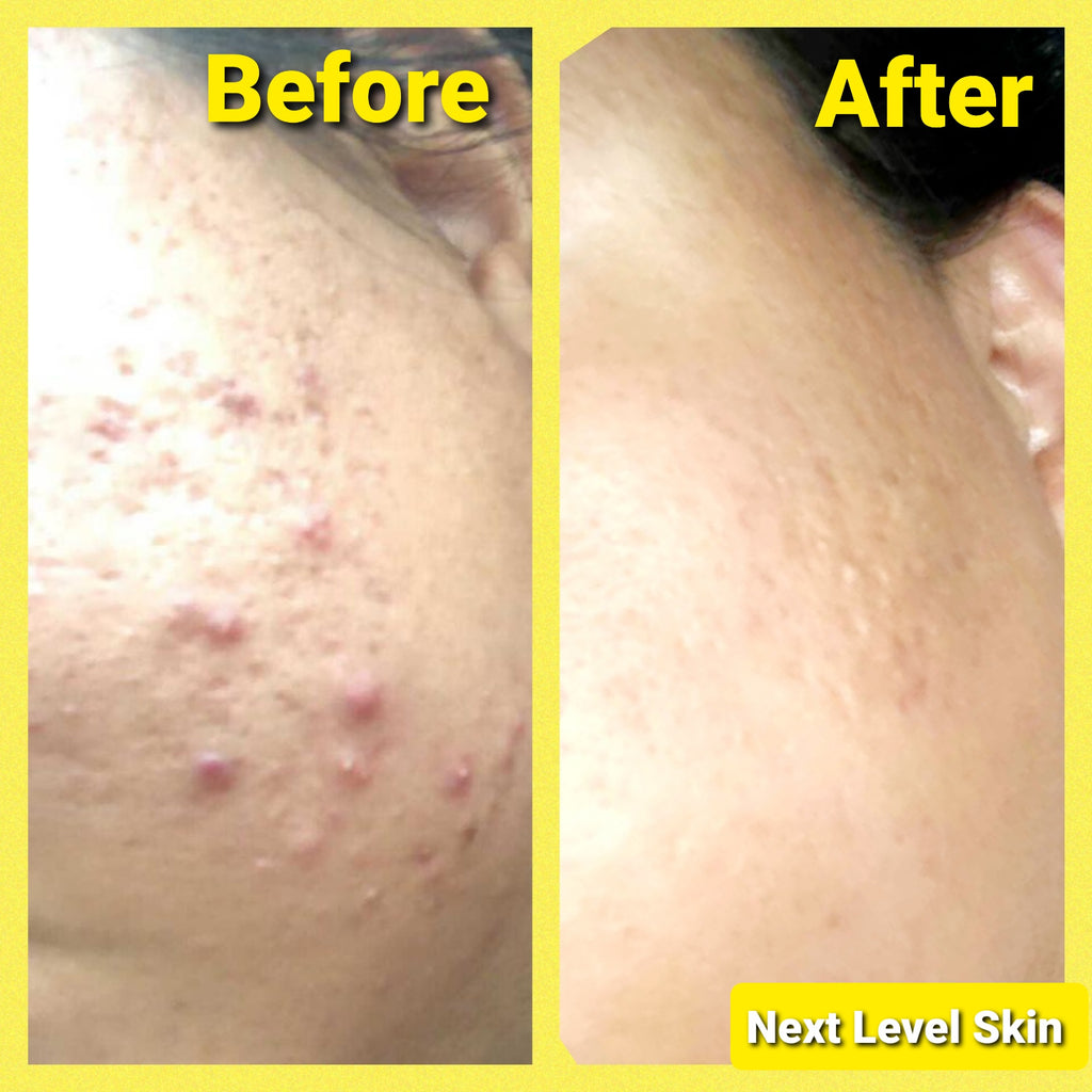 Next Level Skin – Next Level Skin Pty Ltd