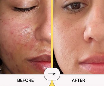 Next Level Skin – Next Level Skin Pty Ltd